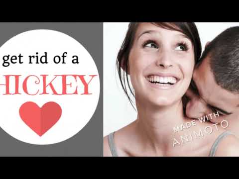 How To Get Rid Of A Hickey - YouTube