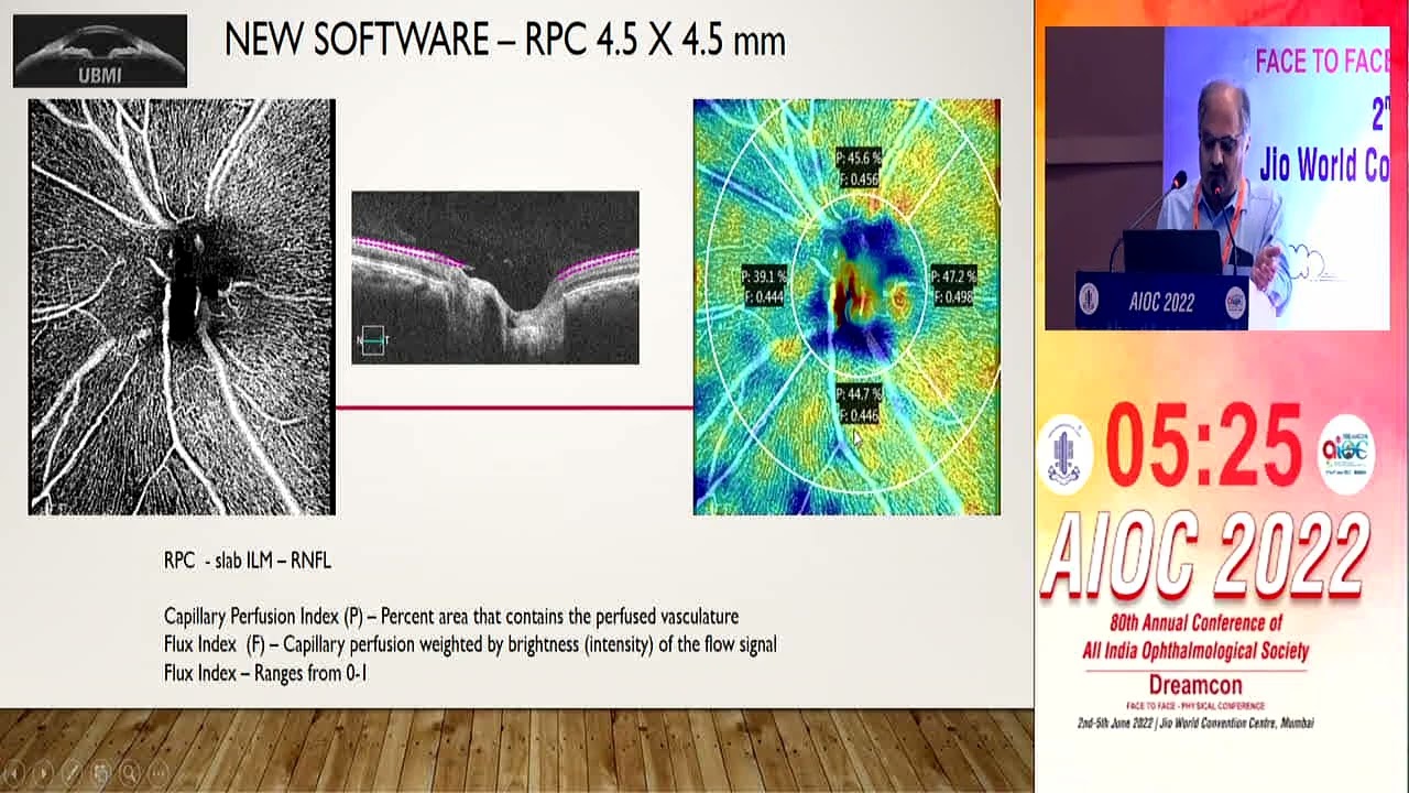 AIOC2022 GP190 topic Dr Deepak Bhatt Role of OCTA in glaucoma - YouTube