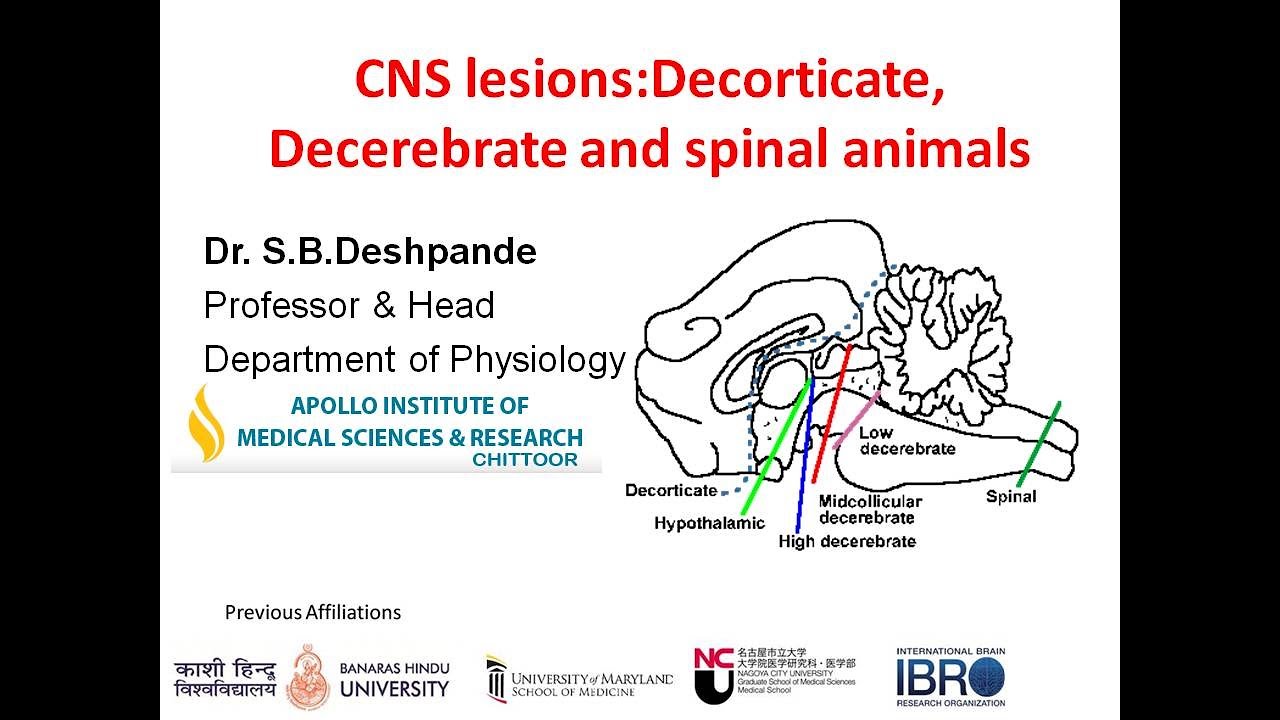 Decerebrate, Decorticate, Decerebellate and Spinal animal models as CNS ...