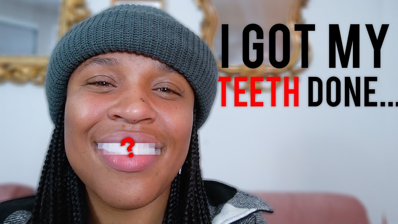 I got my TEETH done!! *Veneers* - YouTube