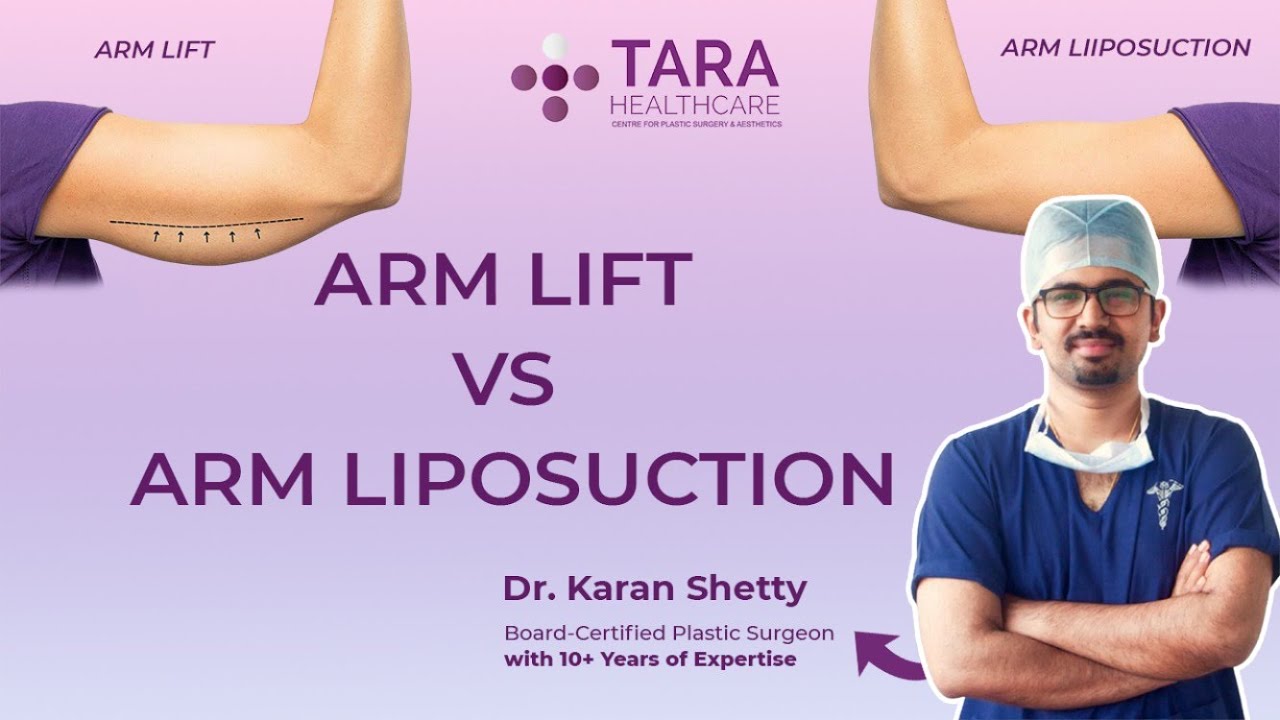 Arm lift vs liposuction - YouTube