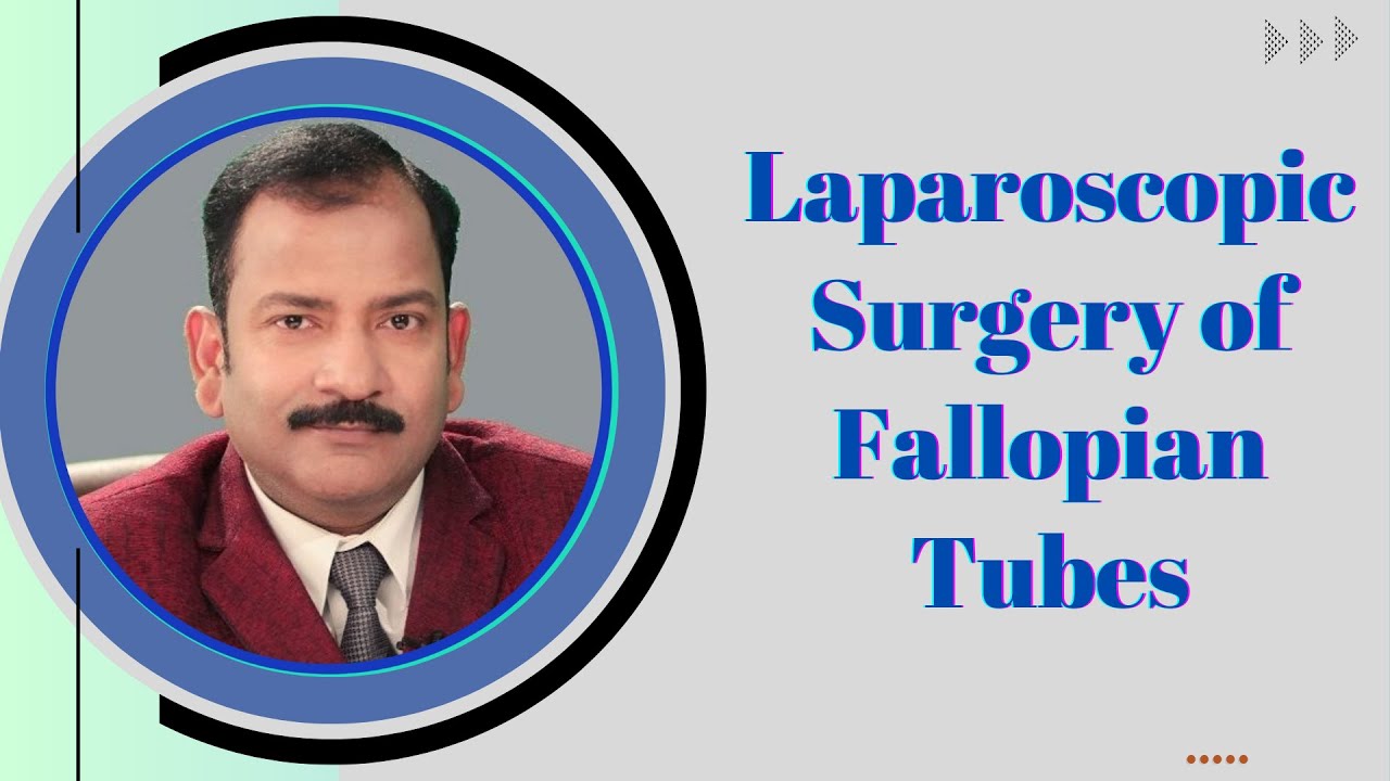 Laparoscopic Surgery for Fallopian Tubes: Procedure, Benefits, and ...