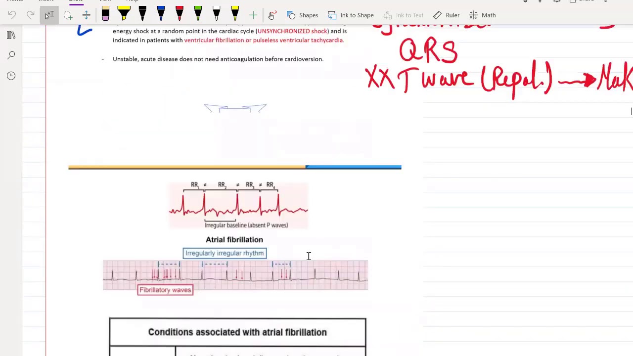 Management of Arrhythmia for USMLE Step 2 CK - (Free trial course in ...
