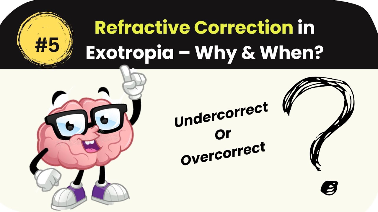 Exotropia & Refractive Correction | When to Correct, Undercorrect, or ...