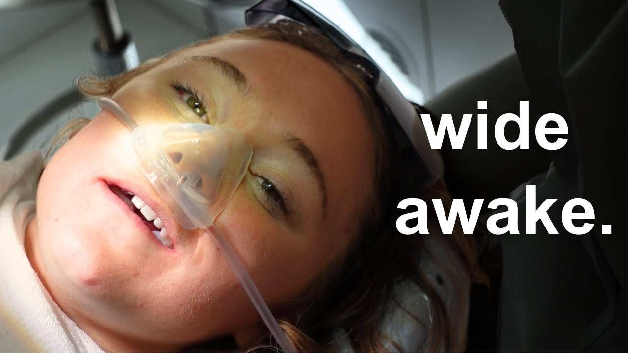 What Happens When You Get All Your Wisdom Teeth Pulled Out? - YouTube