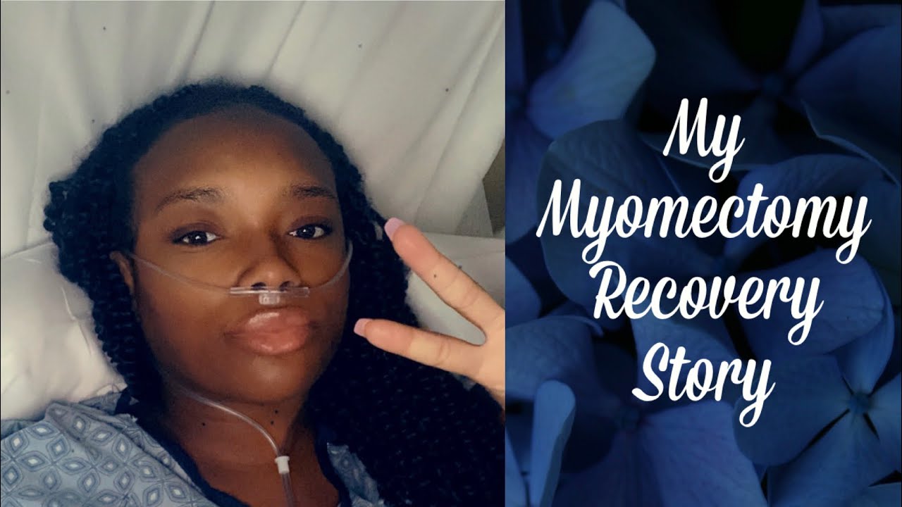 My Myomectomy Recovery Story #fibroid #fibroidremoval #myomectomy # ...