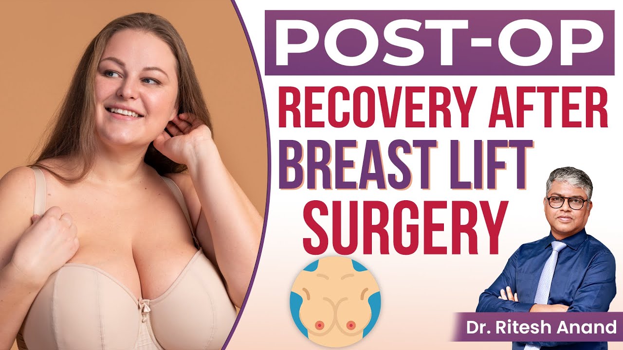 Do s And Don t After Breast Lift Surgery Post OP Recovery After do-s-and-don-t-after-breast-lift-surgery-post-op-recovery-after