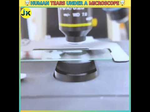 💥💥Human Tears Under A Microscope🤔😲#shortsfact @jkexplores545 - YouTube