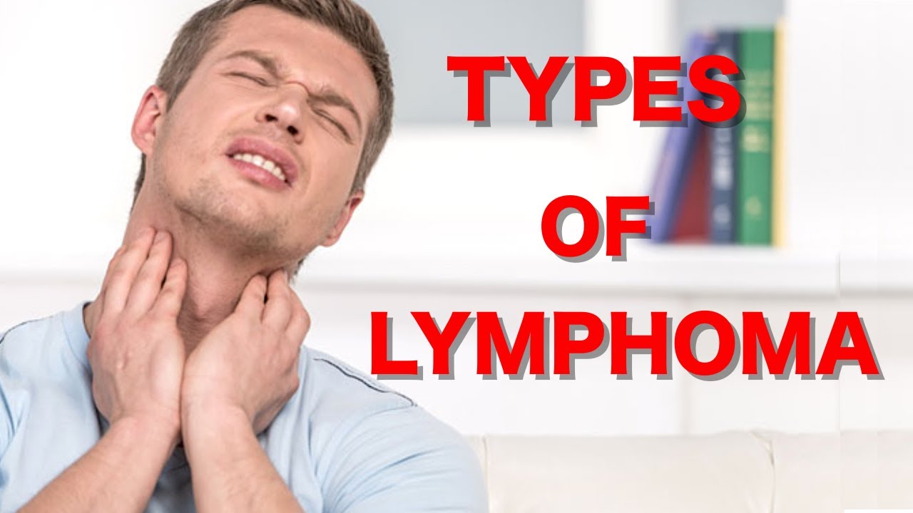 8 Types Lymphoma Cancer