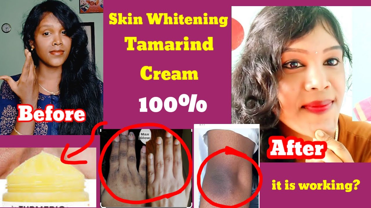 Skin whitening tamarind cream|How to remove darkness around mouth and ...