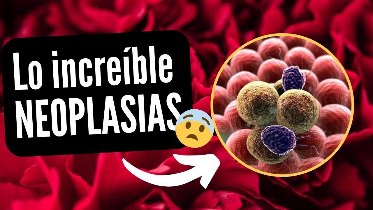 ¿Qué es neoplasia? - Tumores benignos - Tumores malignos - Cáncer ...