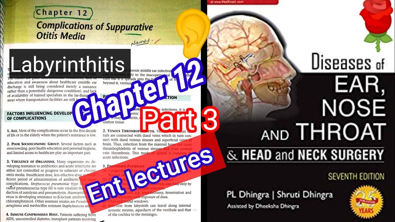 Labyrinthitis. types 🔴 Complications of Suppurative otitis media ...