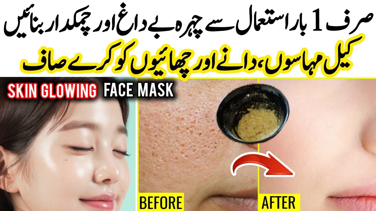 Homemade Face Mask For Whitening & Glowing Skin | Remove Dark Spots ...