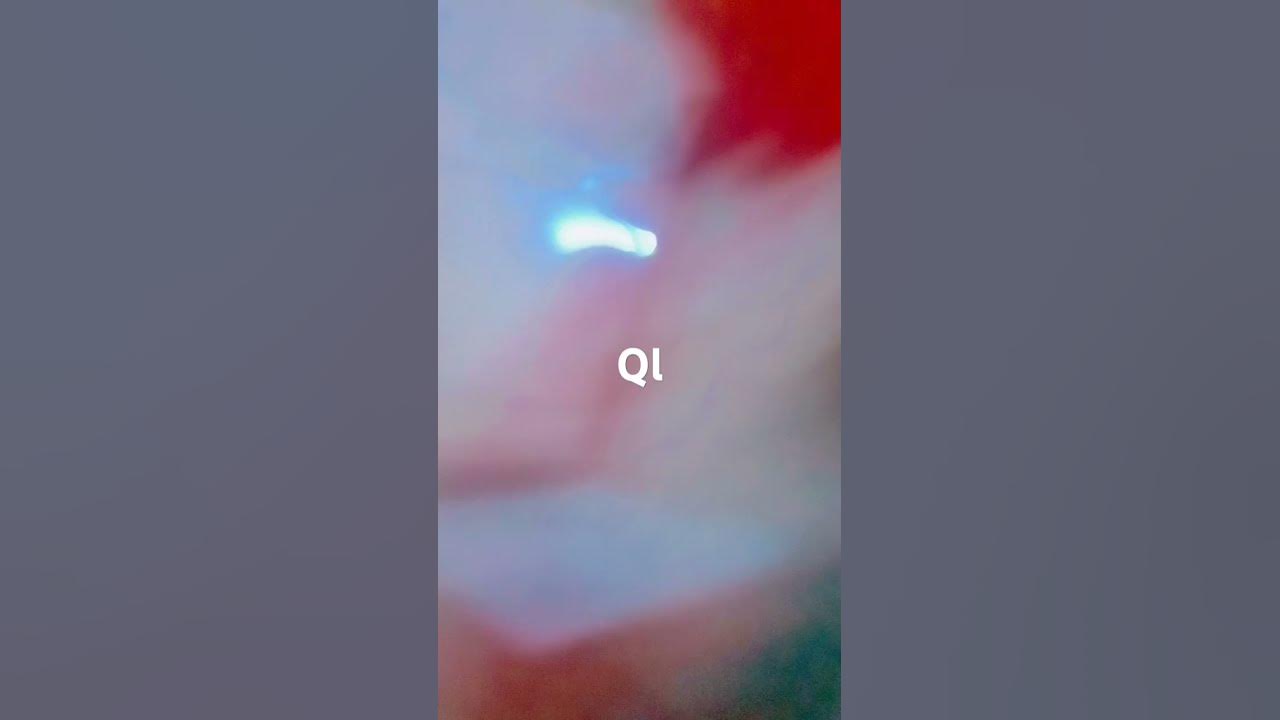 Ql - YouTube