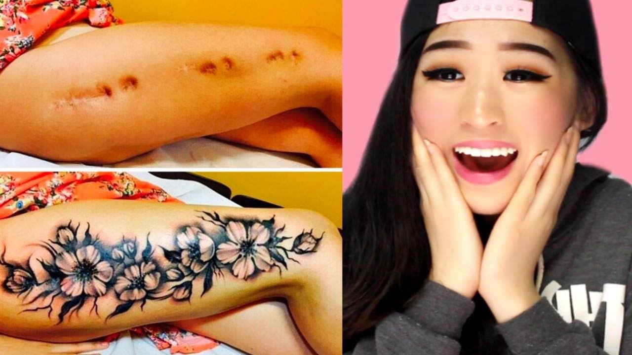 Amazing Tattoos That Turn Scars Into Works Of Art - YouTube
