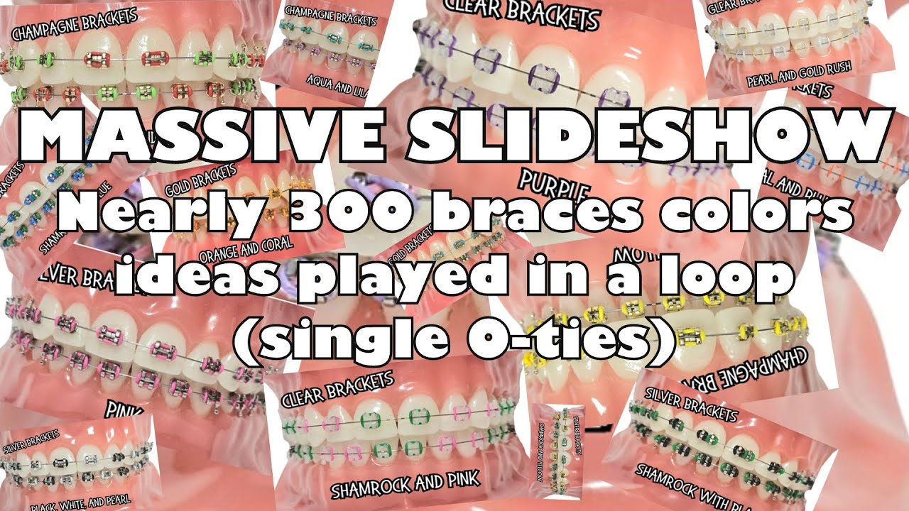Slideshow of nearly 300 BRACES COLORS 8-hours! (single o-ties) - YouTube