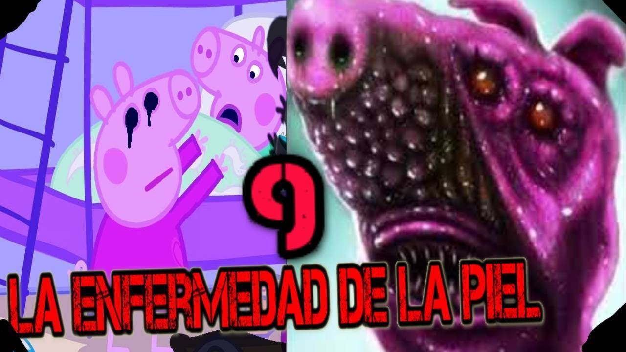 CREEPYPASTA PEPPA PIG - LA ENFERMEDAD DE LOS HUEVOS EN LA PIEL parte 9 ...