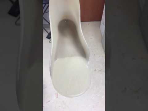 Custom AFO Fabrication - Full Foot vs Sulcus Lengty Foot Plate - YouTube