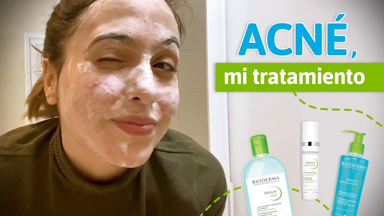EP 2. Mi tratamiento para el ACNÉ | Karla Esquivel | Acompáñenme a mi ...