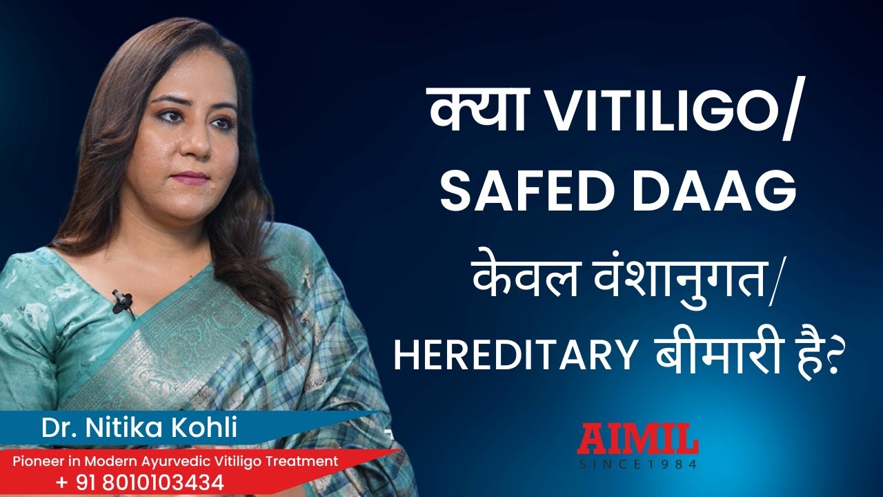 Who can develop Safed Daag/Vitiligo? Is it passed through heredity ...
