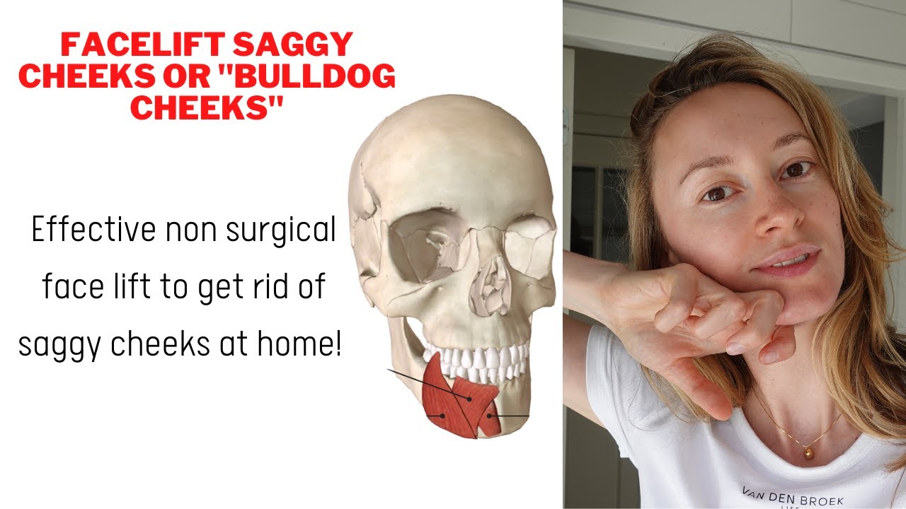How to get rid of sagging cheeks - YouTube