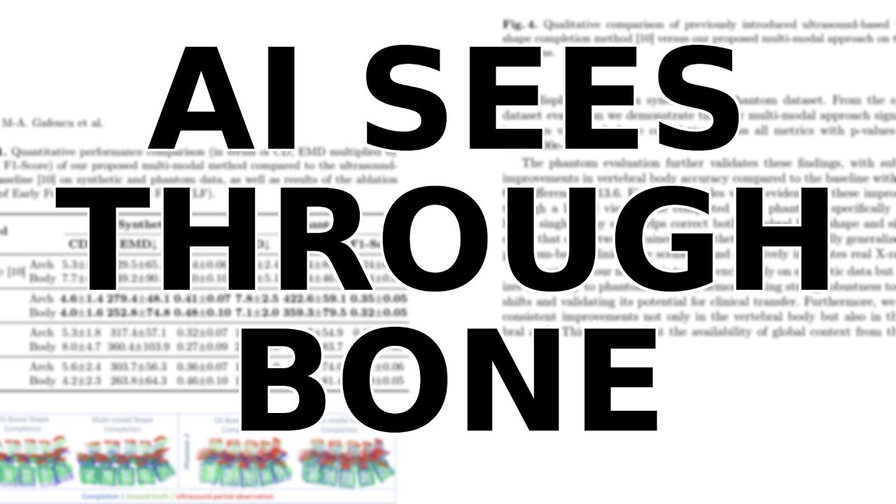 AI Builds a Live 3D Map of Your Spine From Ultrasound and a Single X ...