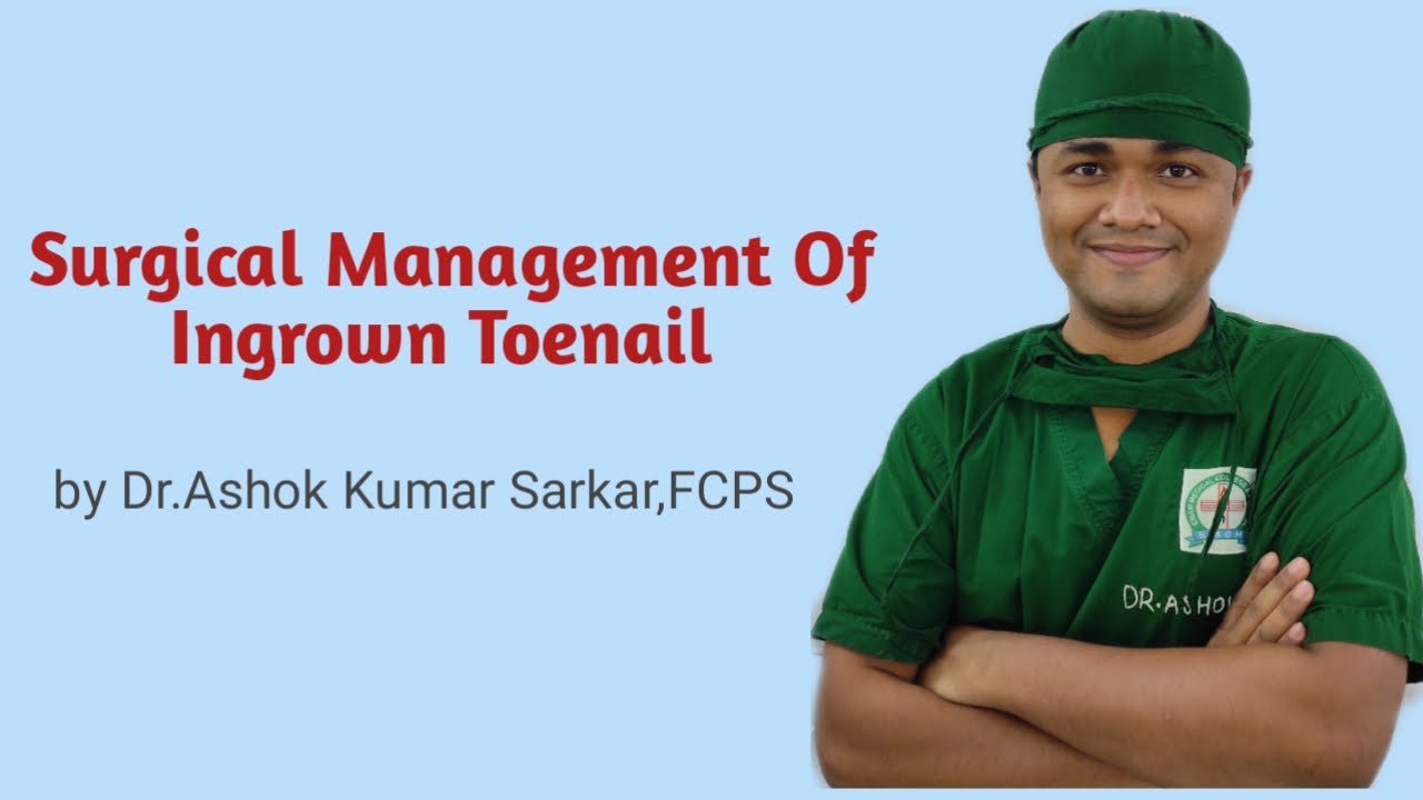 Surgical Management of Ingrown Toenail by Dr.Ashok Kumar Sarkar,FCPS - YouTube