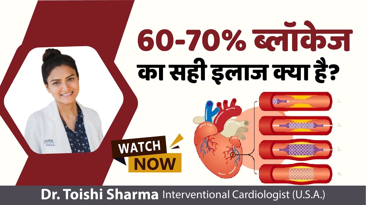60 - 70% ब्लॉकेज का सही इलाज क्या है? Heart Blockage Treatment In Delhi ...