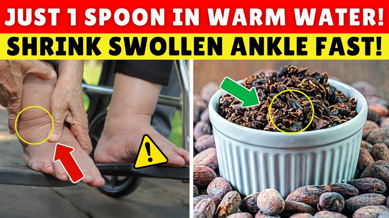 Ankle Swelling: 1 Daily Habit That Drains Water Retention Overnight ...
