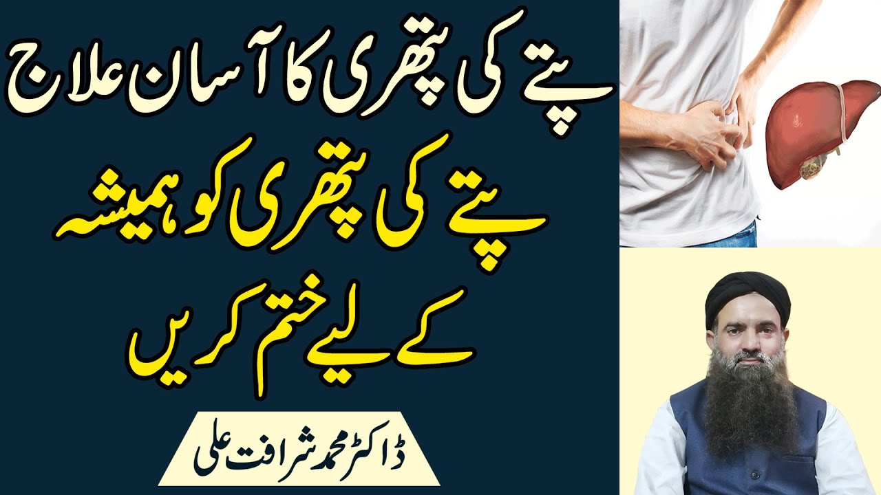 Pittay/Gallstone Ka Dard Ka ilaj | Pittay Ki Pathri Ka ilaj | Gallstone ...