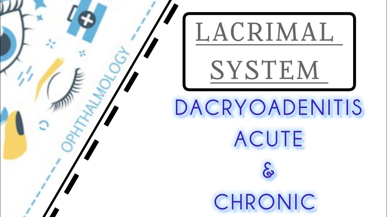 LACRIMAL SYSTEM LECTURE -3 |ACUTE & CHRONIC DACRYOADENITIS| - YouTube