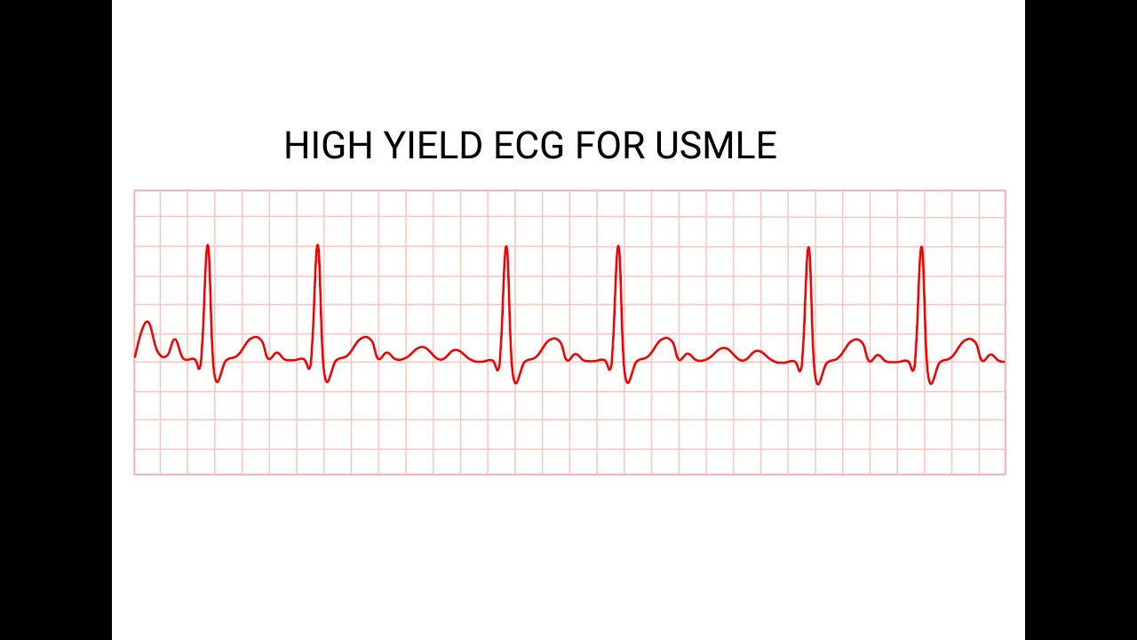 HIGH YIELD USMLE ECG #2 - YouTube