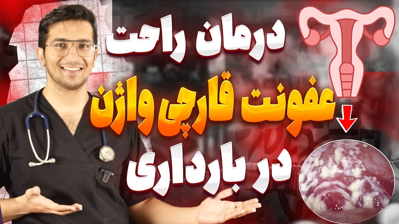درمان و پیشگیری از عفونت قارچی واژن در بارداری Youtube