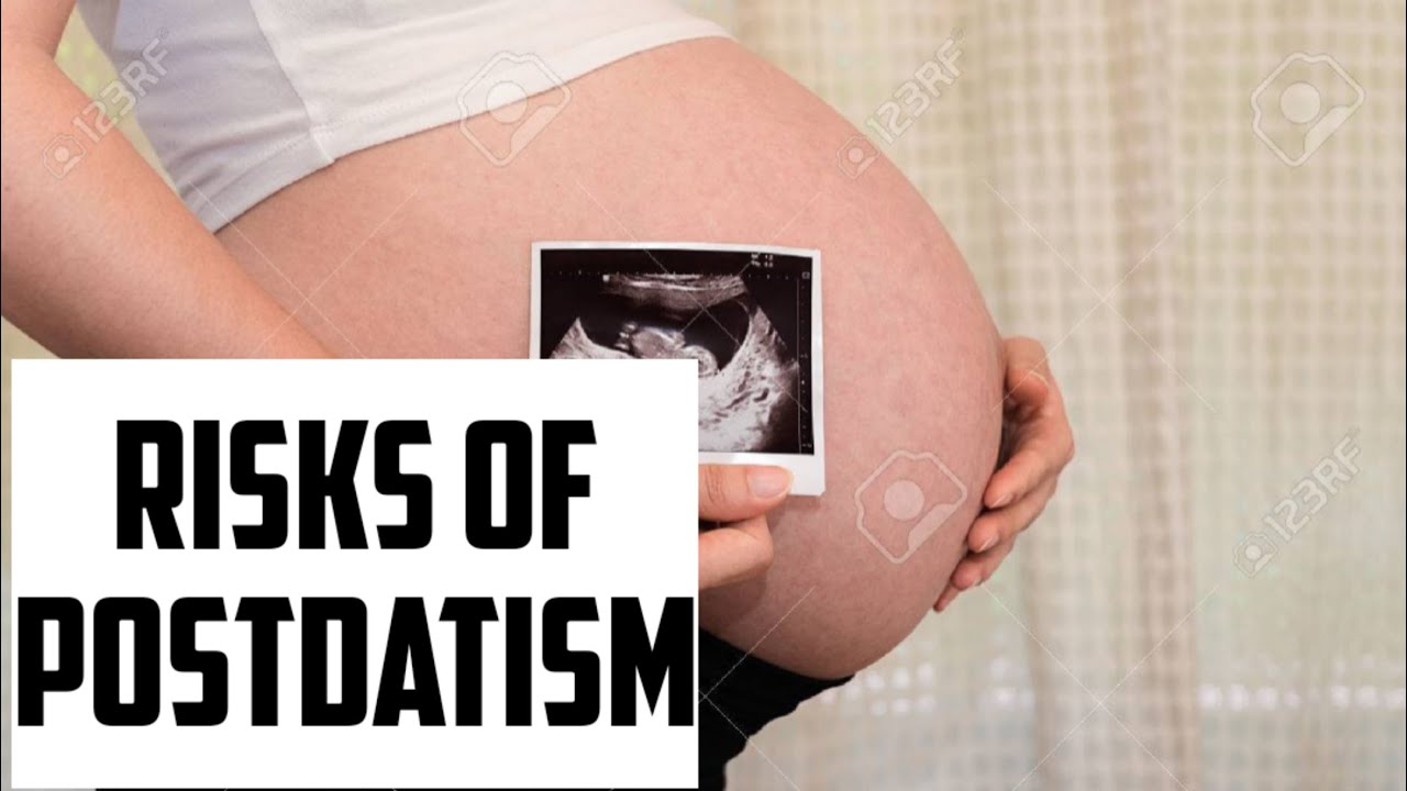 Risks of Postdatism/Going beyond your EDD in pregnancy. # ...