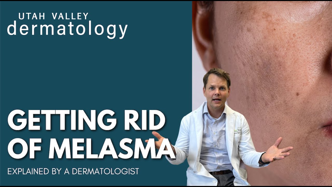 Getting Rid of Melasma | Utah Valley Dermatology - YouTube
