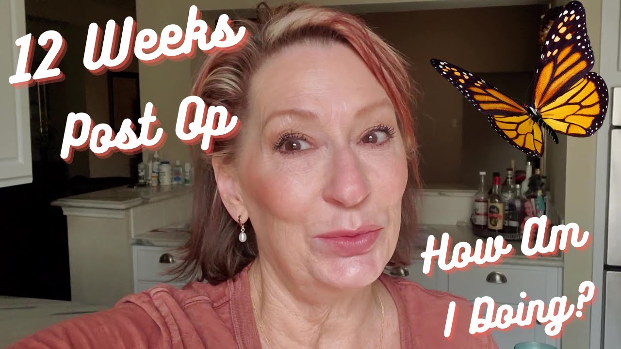 12 Weeks Post OP HIP ARTHROSCOPY SURGERY | GLUTEUS MEDIUS and MINIMUS ...