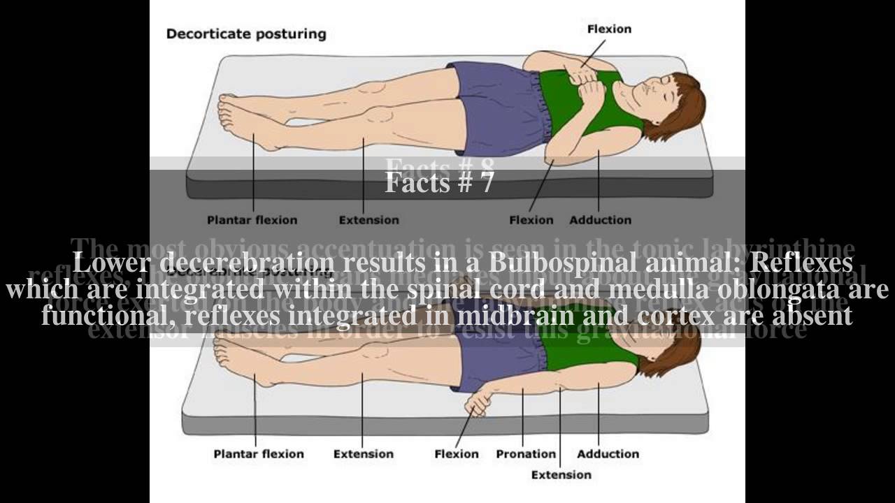 Decerebration Top # 11 Facts - YouTube