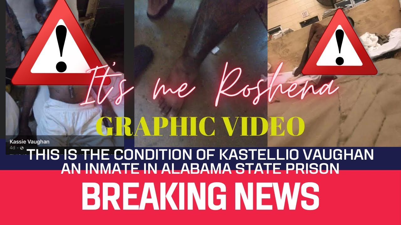 THE HORRIBLE CONDITION OF AN ALABAMA STATE INMATE. JUSTICE FOR ...