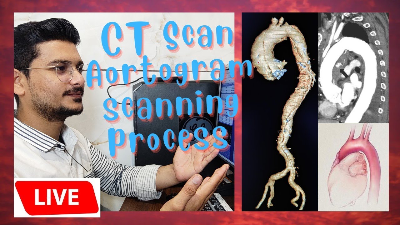 live CT Scan Aortogram scanning process and techniques | scanning ...