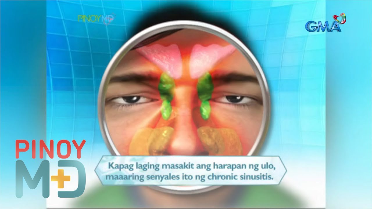 Ano-ano ang maaaring dahilan sa labis na pagsakit ng ulo? | Pinoy MD ...