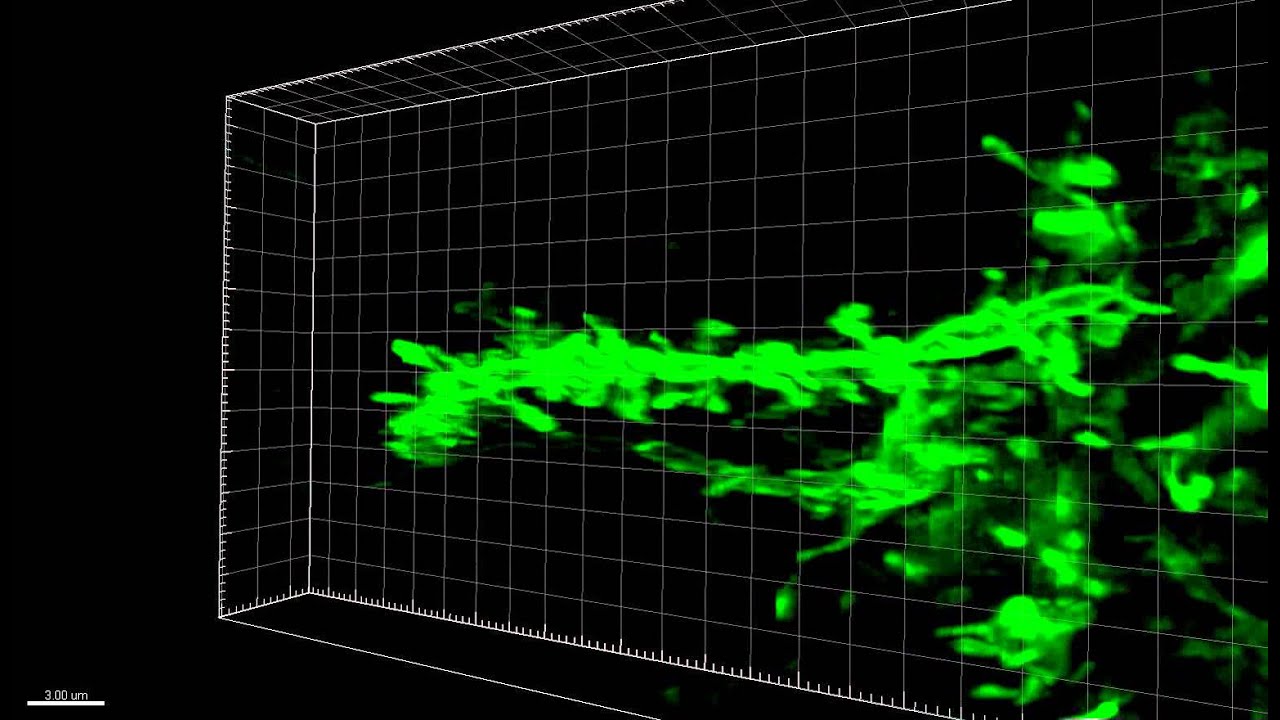 Diolistic (DiO) labeling of medium spiny neurons in the Nucleus ...