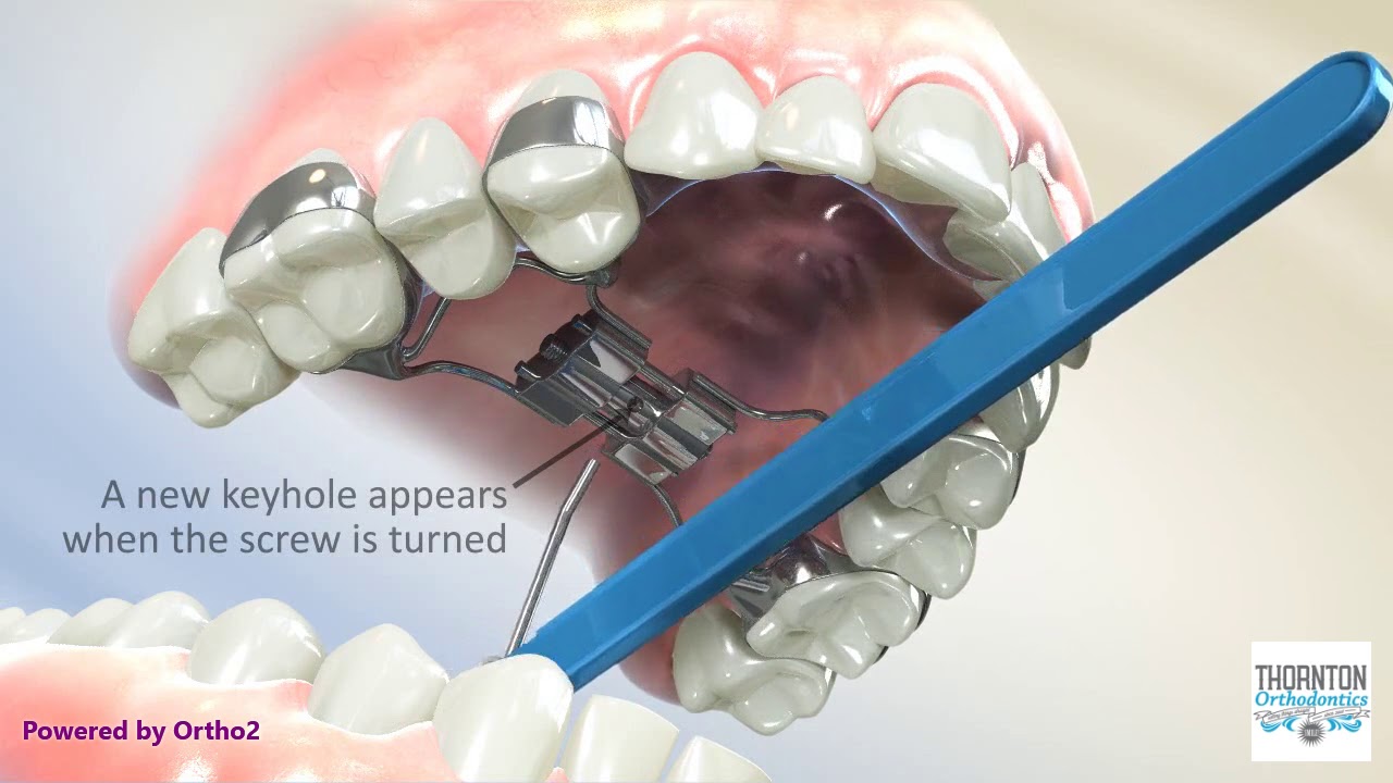 Hyrax-No Diastema - YouTube