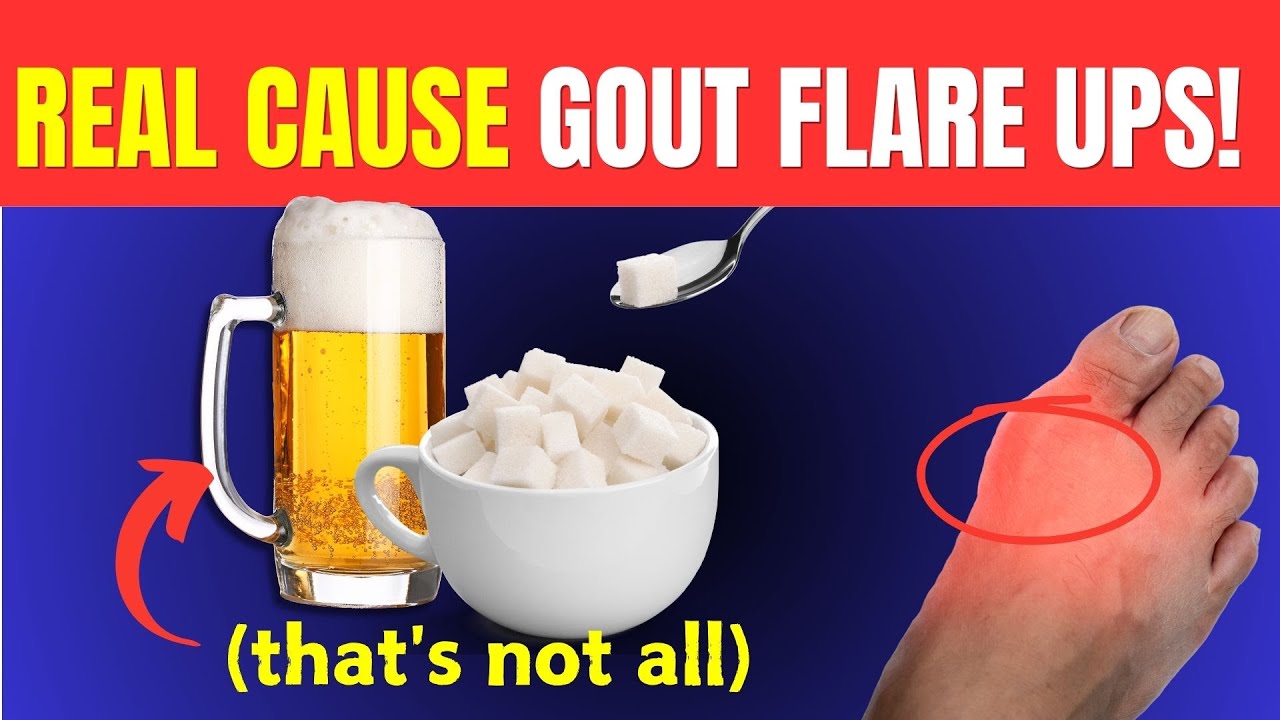 REAL cause of GOUT attacks DISCOVERED! 6 home remedies for fast relief ...
