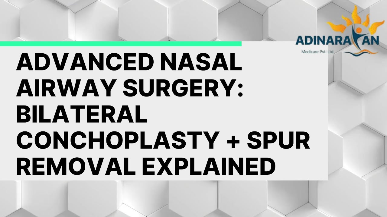 Advanced Nasal Airway Surgery Bilateral Conchoplasty + Spur Removal ...