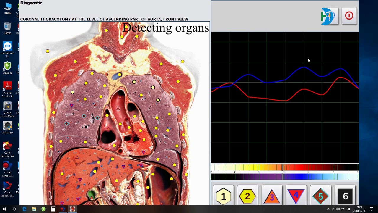 The quantum resonace magnetic health body scanner how to use - YouTube