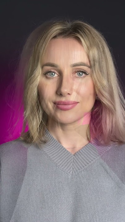 Ринопластика как выглядит носик на10 сутки после операции Youtube