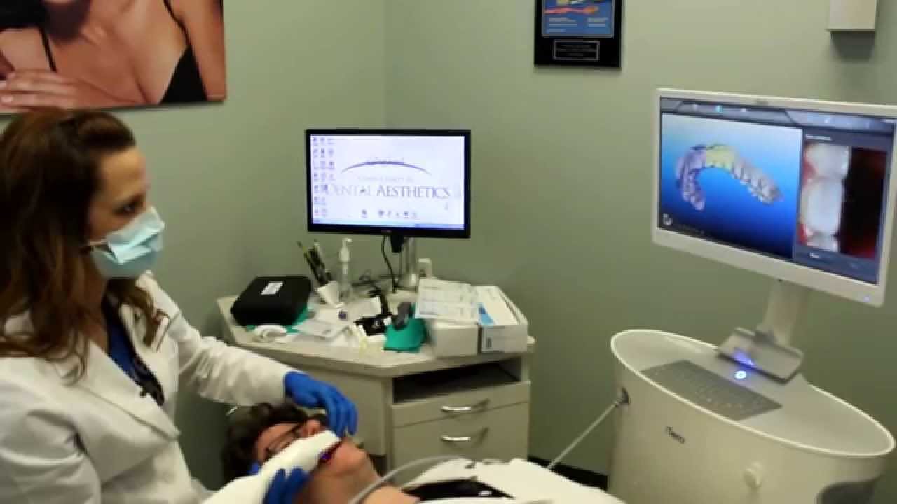 Megan's 3:15 iTero Scan for Invisalign - YouTube
