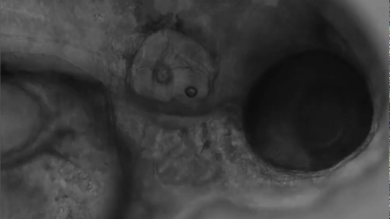 Live Zebrafish imaging at 10x magnification - YouTube