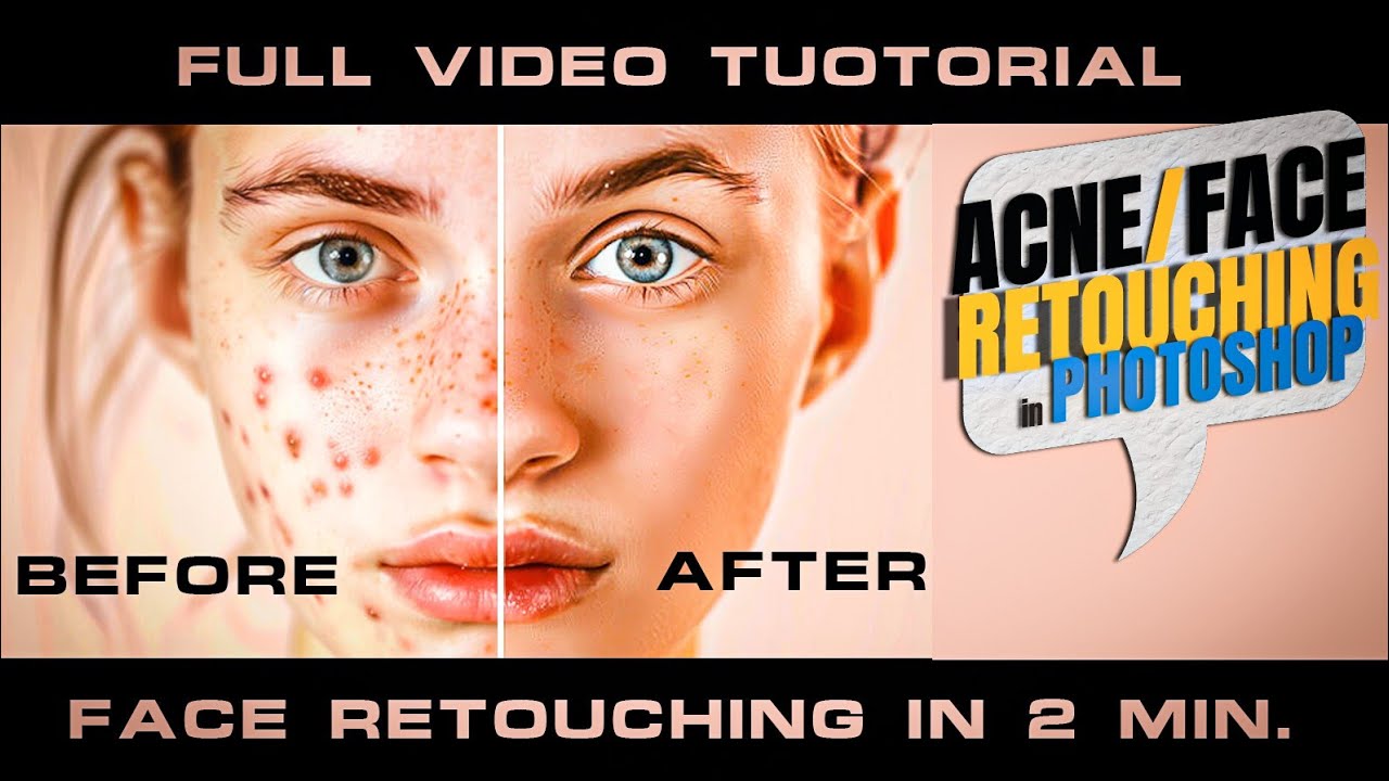 How To Remove Acne In Photoshop (Beginner Tutorial) - YouTube