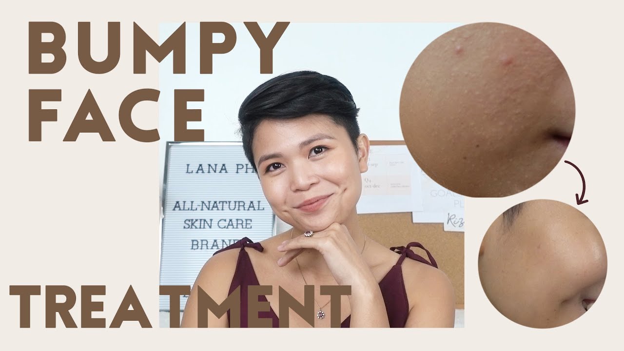 Bumpy Face and How to Heal Them - YouTube